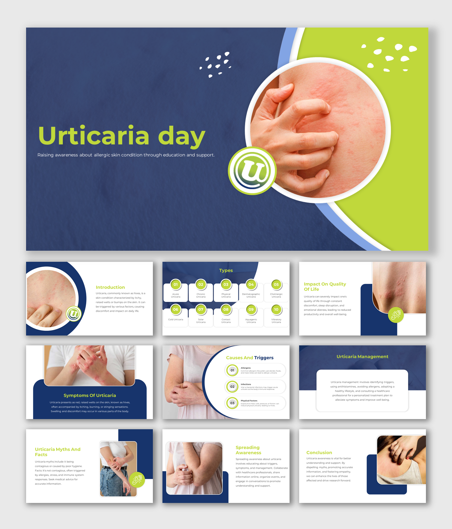 Use Urticaria Day PowerPoint And Google Slides Templates