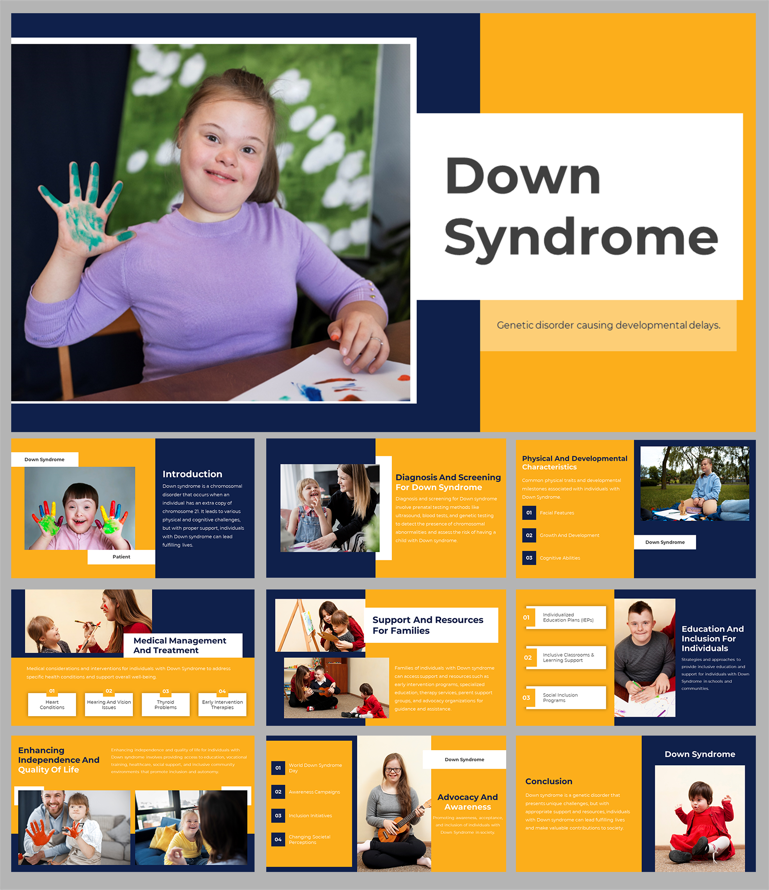 Down Syndrome PPT Presentation and Google Slides Templates
